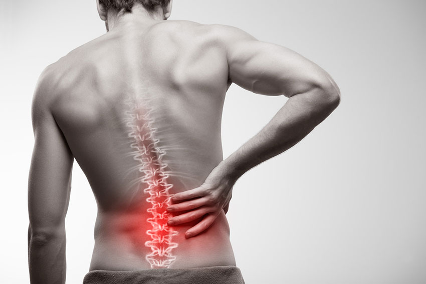 Back Pain | Pro Point Physio